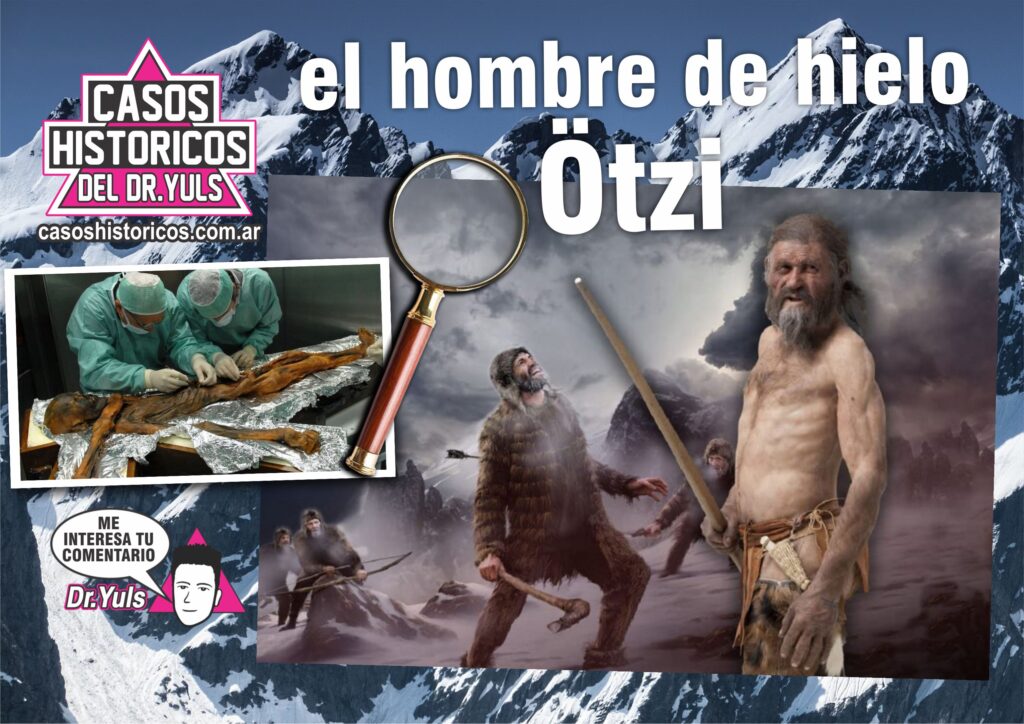 Ötzi, el Hombre de Hielo